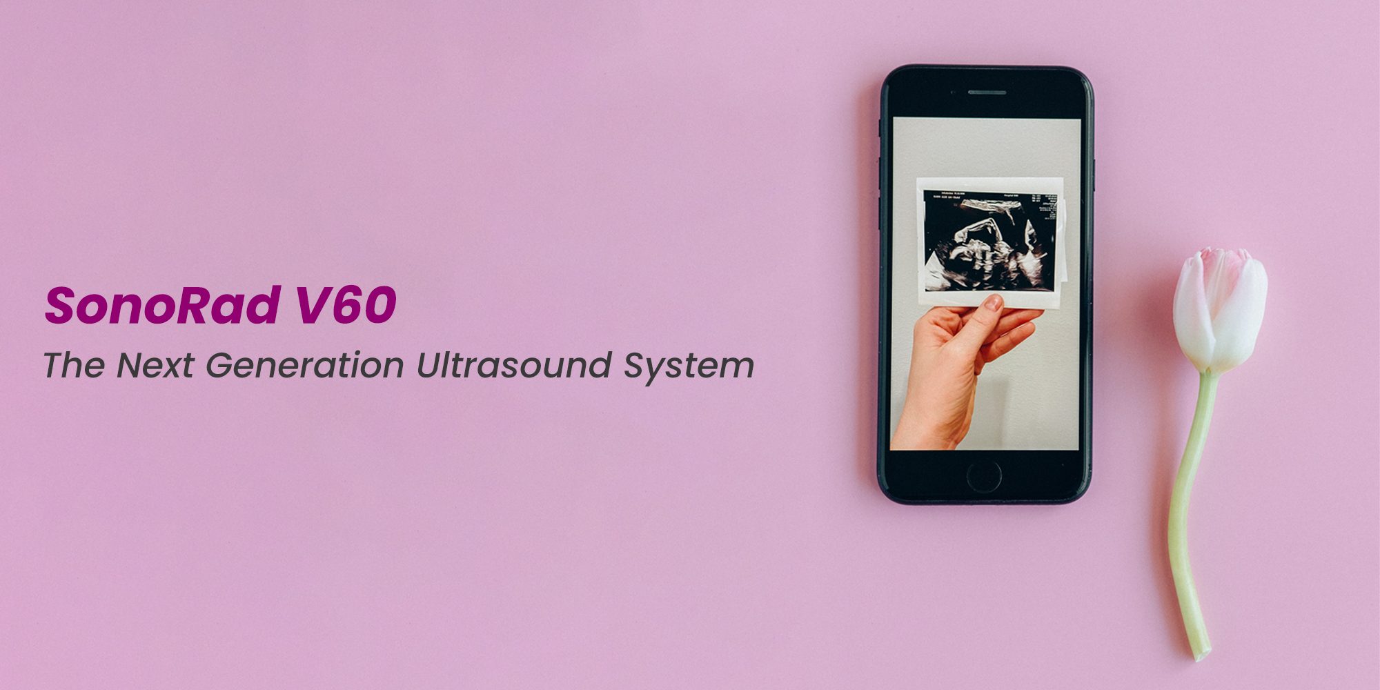 Introducing the Sonorad V60 - The Next Generation Ultrasound System