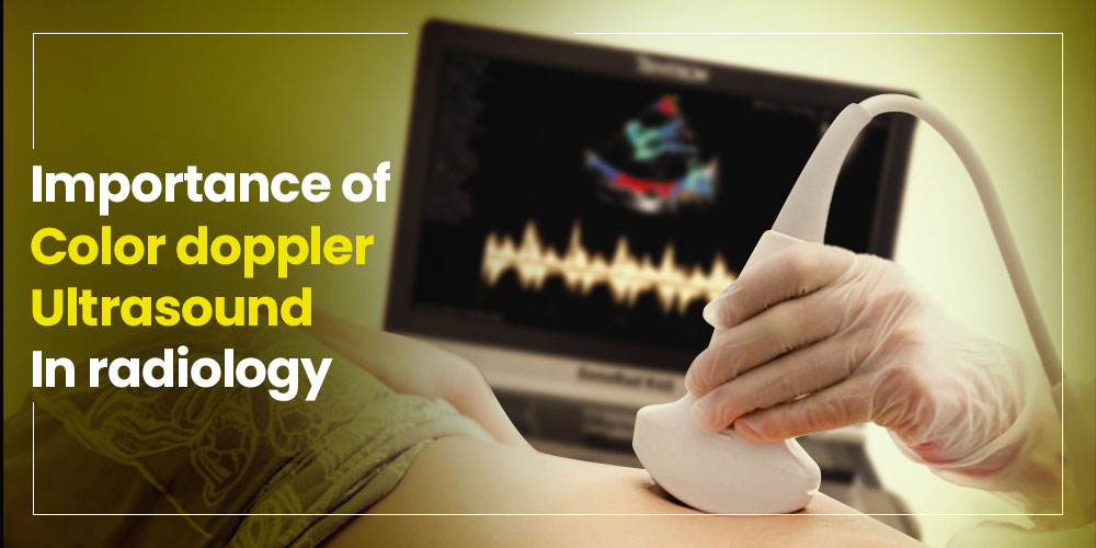 Importance Of Color Doppler Ultrasound In Radiology Blog Trivitron Healthcare Solutions