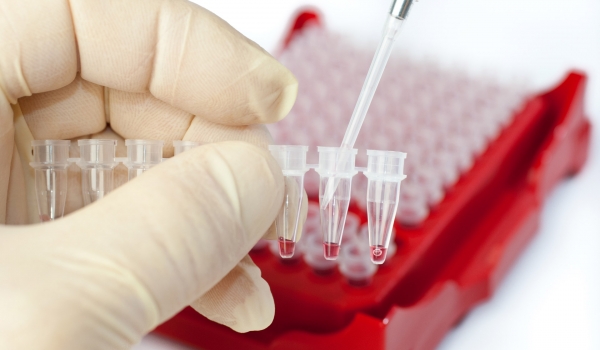 Molecular Diagnostics Test kits suppliers for Infectious Diseases ...